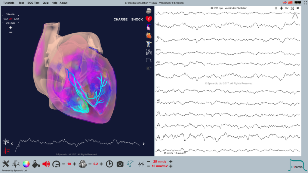 Epicardio Simulation™ - ECG simulation for hospitals